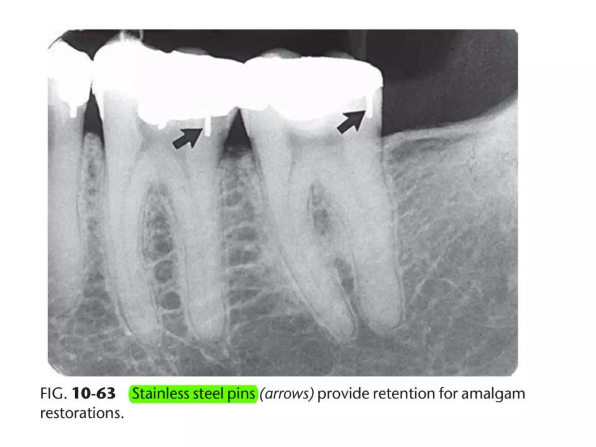 Intraoral radiographic anatomy | PPTX