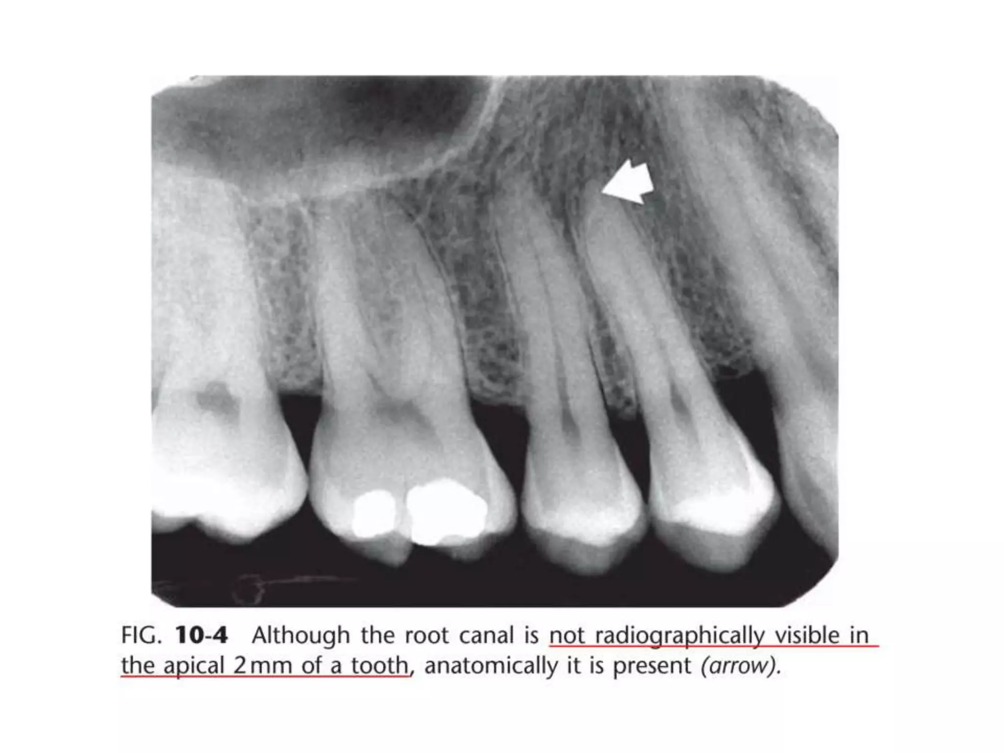 Intraoral radiographic anatomy | PPTX