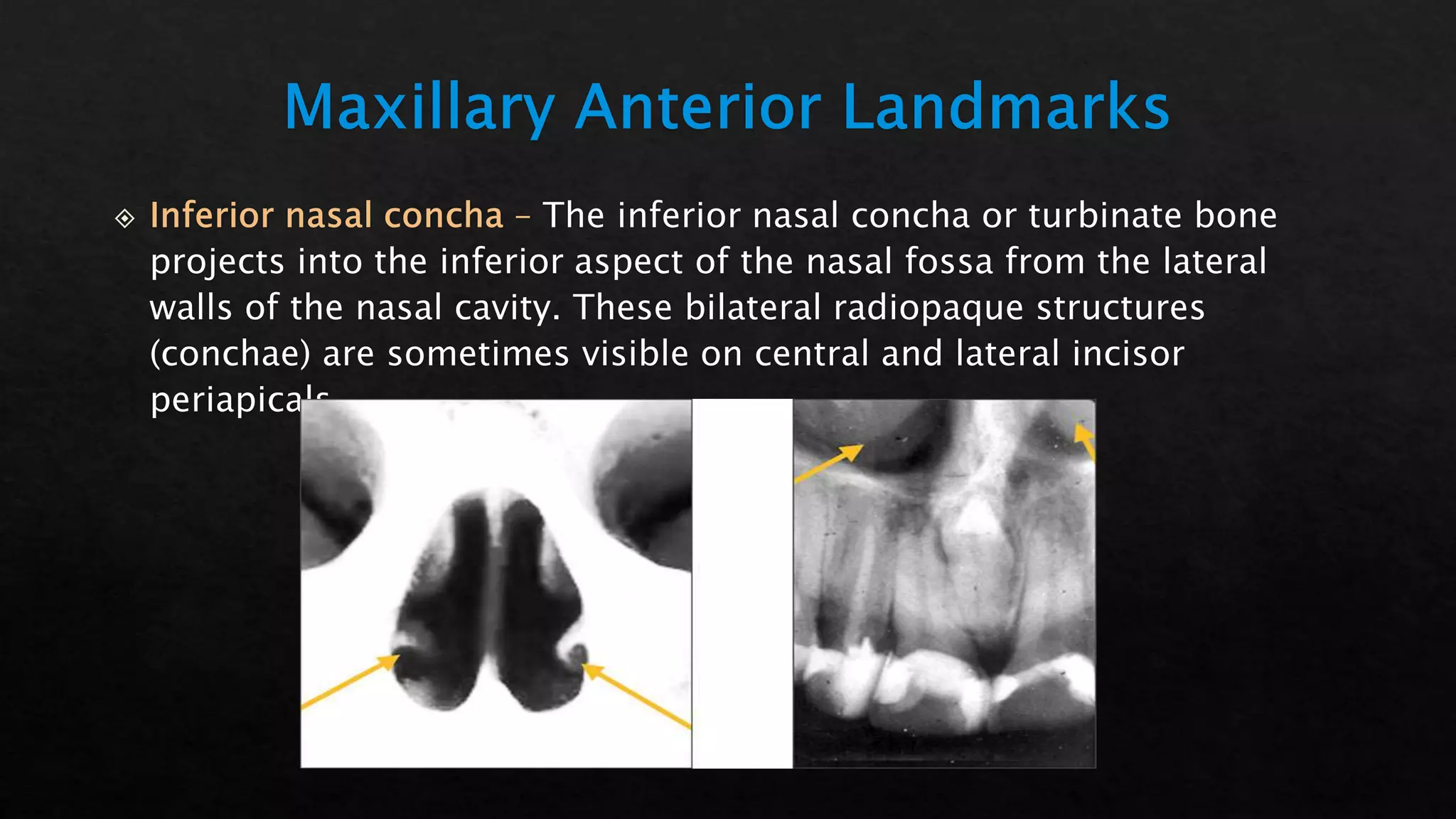 Intraoral Radiographic Anatomy.pptx