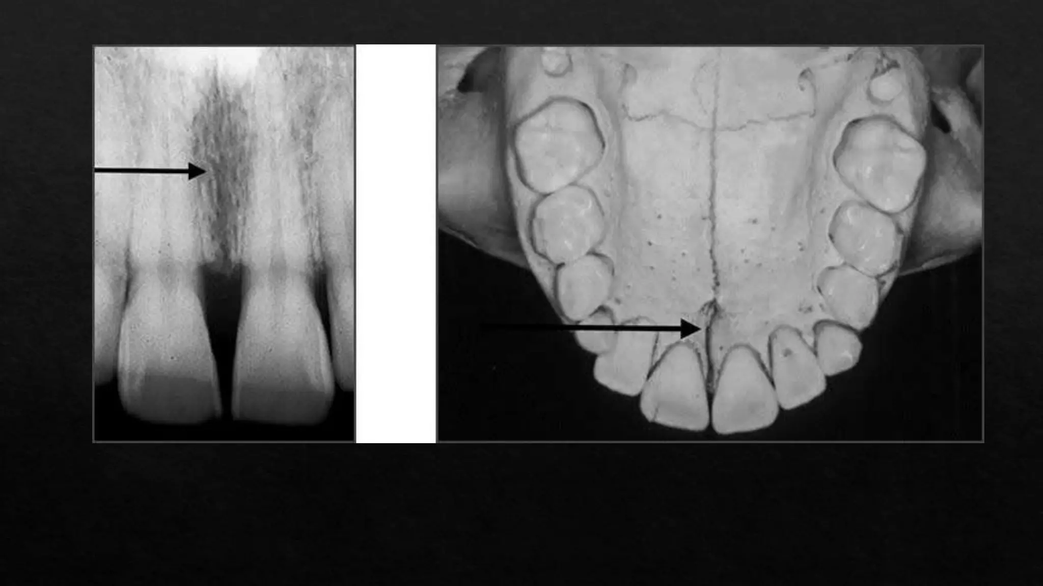 Intraoral Radiographic Anatomy.pptx