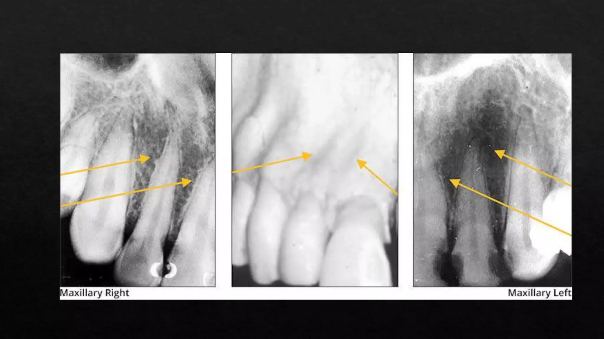 Intraoral Radiographic Anatomy.pptx