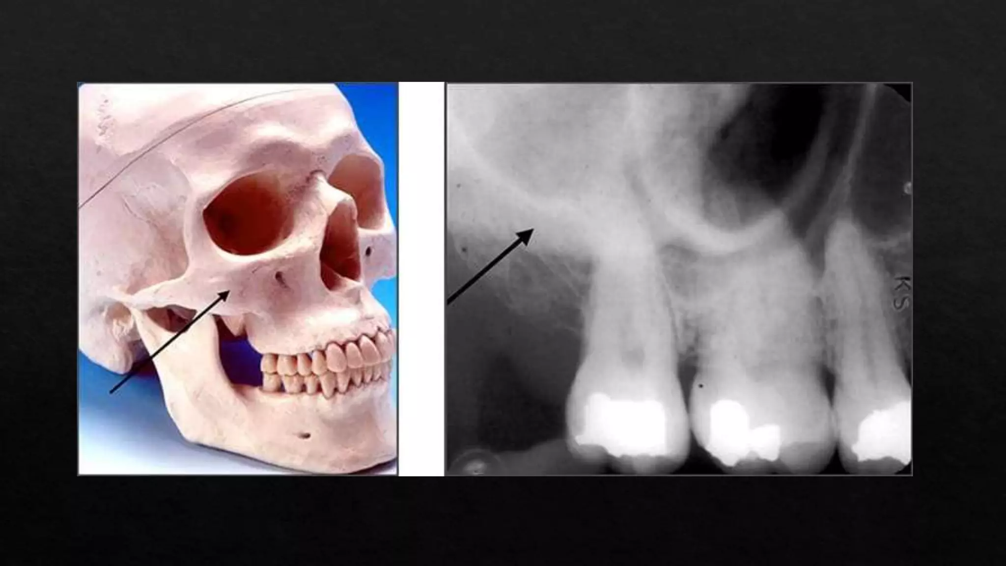 Intraoral Radiographic Anatomy.pptx