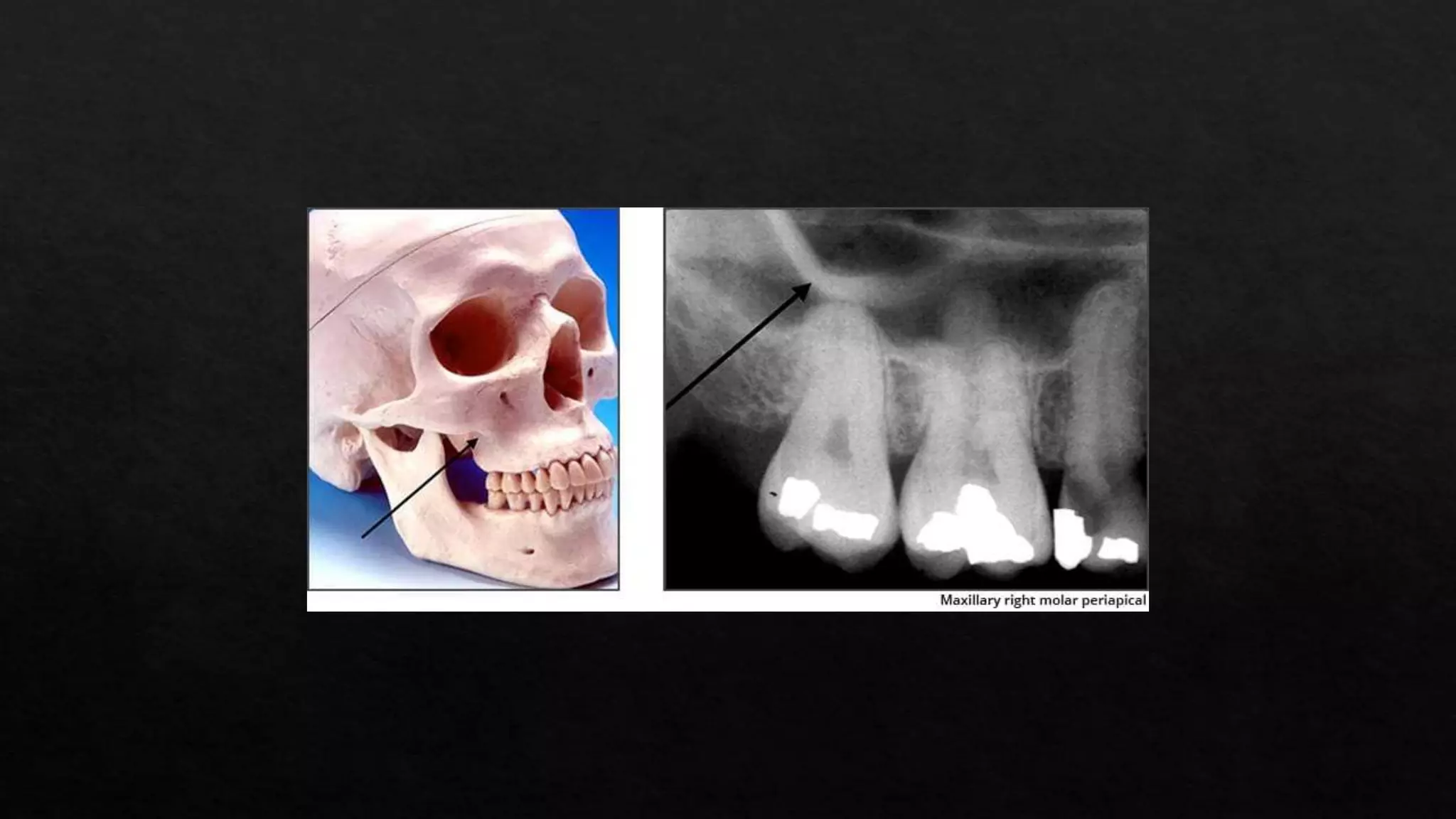 Intraoral Radiographic Anatomy.pptx
