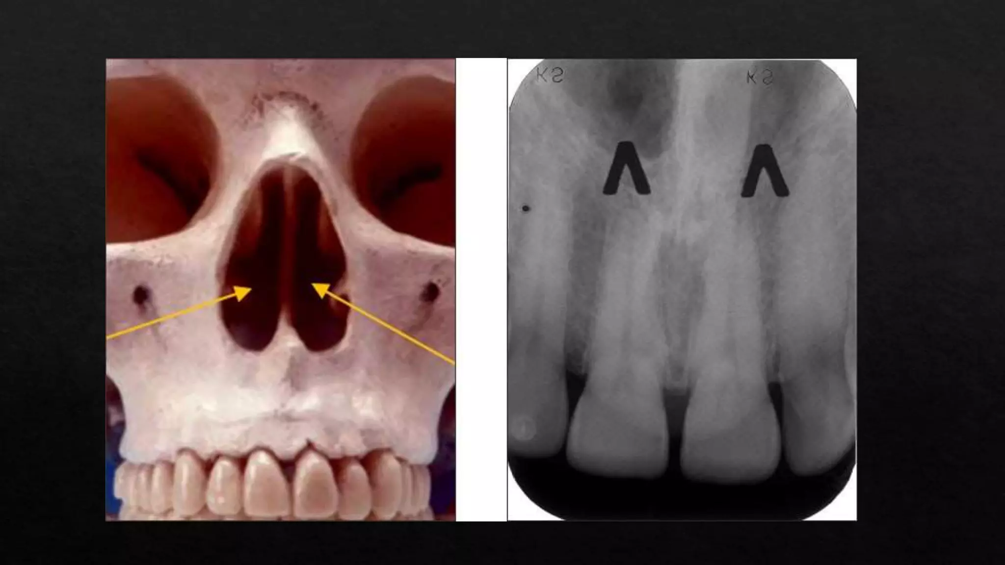 Intraoral Radiographic Anatomy.pptx