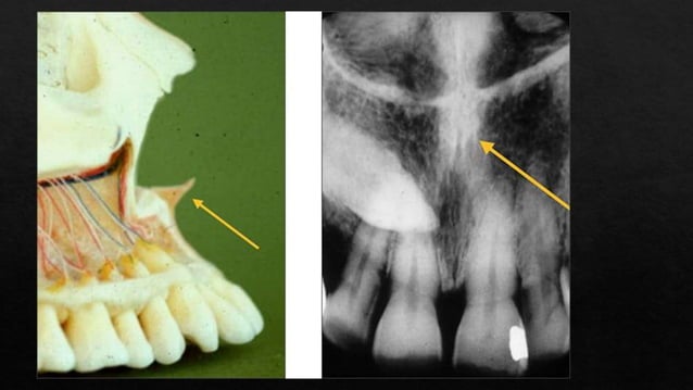 Intraoral Radiographic Anatomy.pptx