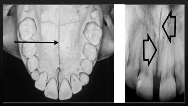 Intraoral Radiographic Anatomy.pptx