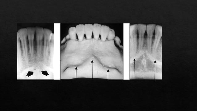 Intraoral Radiographic Anatomy.pptx