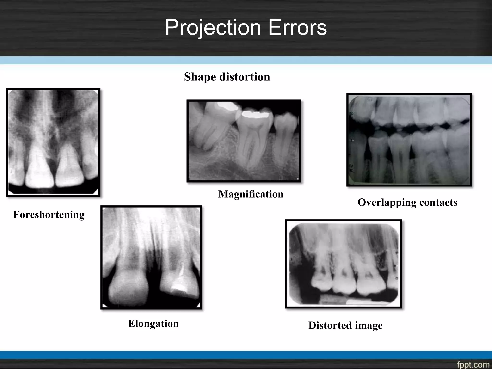 Intraoral radiographic processing and faults | PPTX
