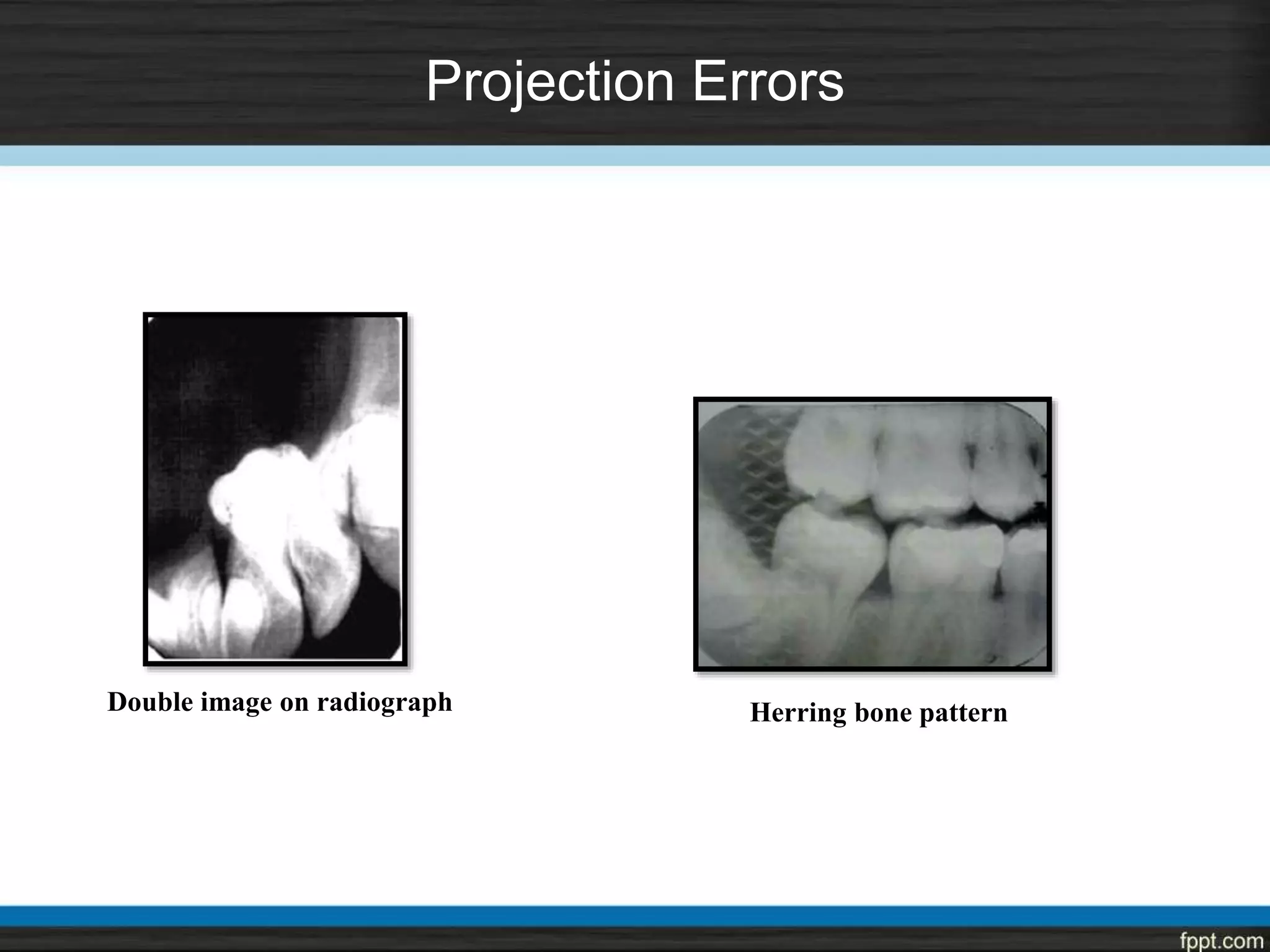 Intraoral radiographic processing and faults | PPTX
