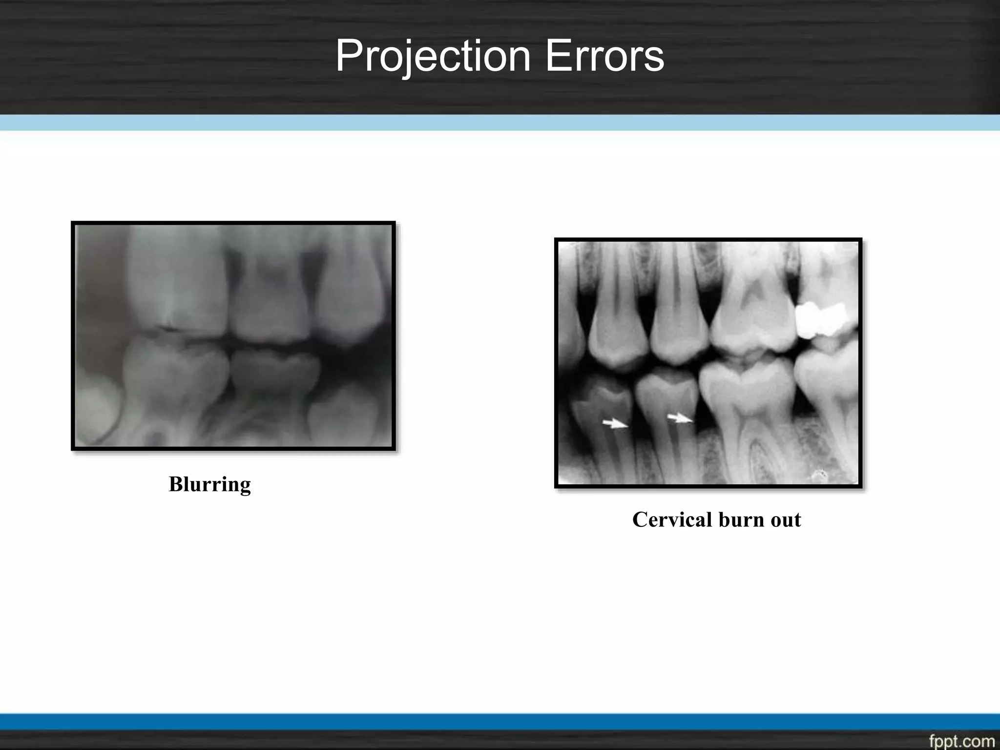 Intraoral radiographic processing and faults | PPTX