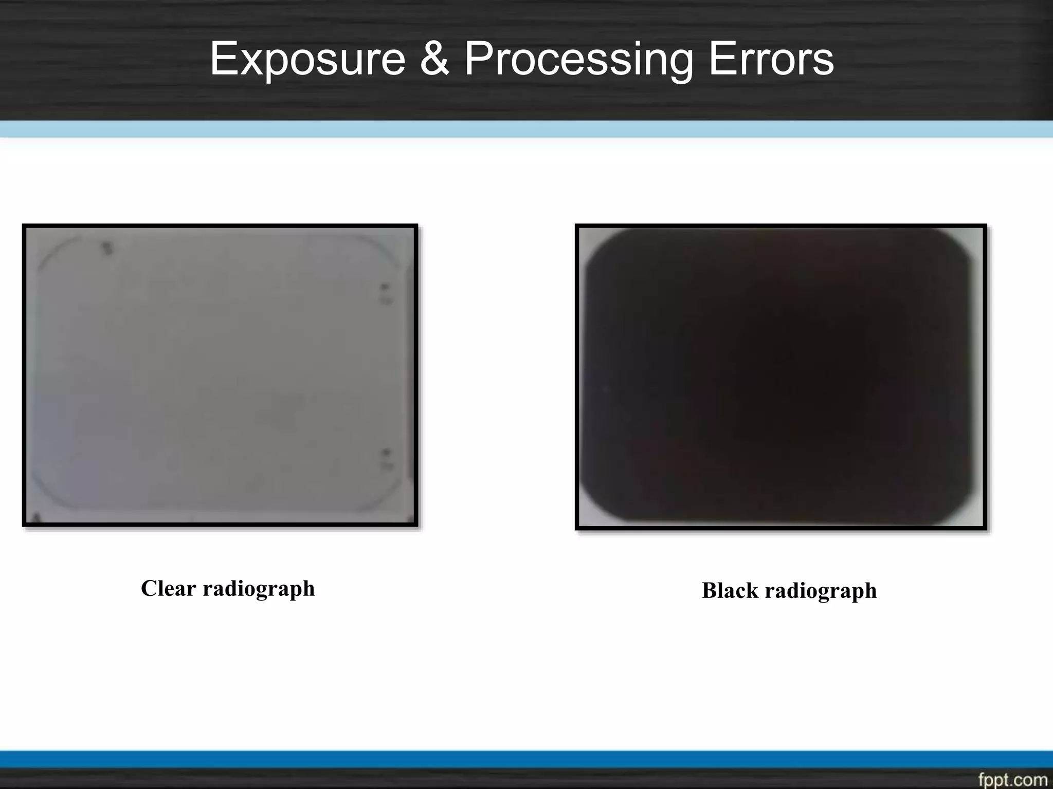 Intraoral radiographic processing and faults | PPTX
