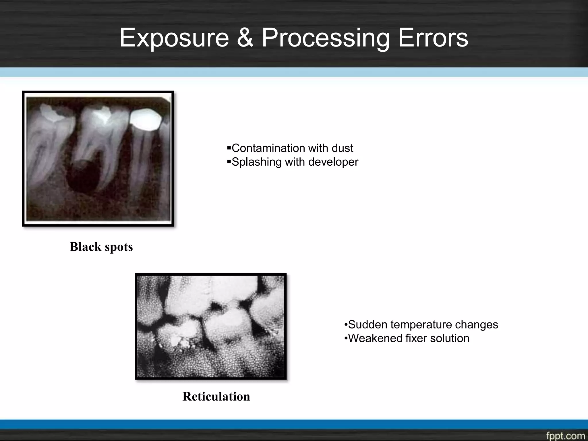 Intraoral radiographic processing and faults | PPTX