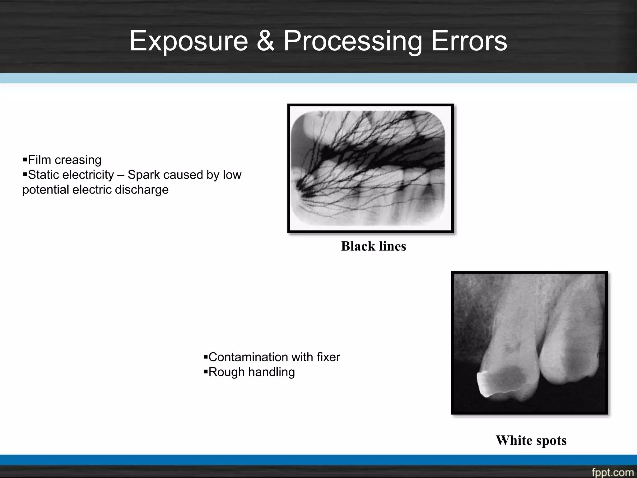 Intraoral radiographic processing and faults | PPTX