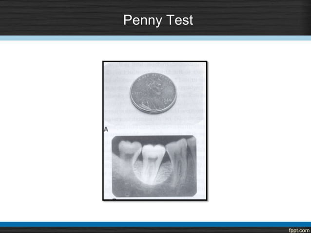 Intraoral radiographic processing and faults | PPTX