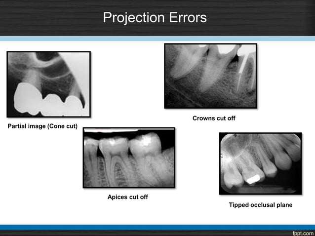 Intraoral radiographic processing and faults | PPTX