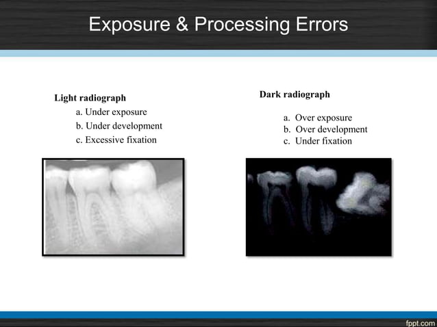 Intraoral radiographic processing and faults | PPTX