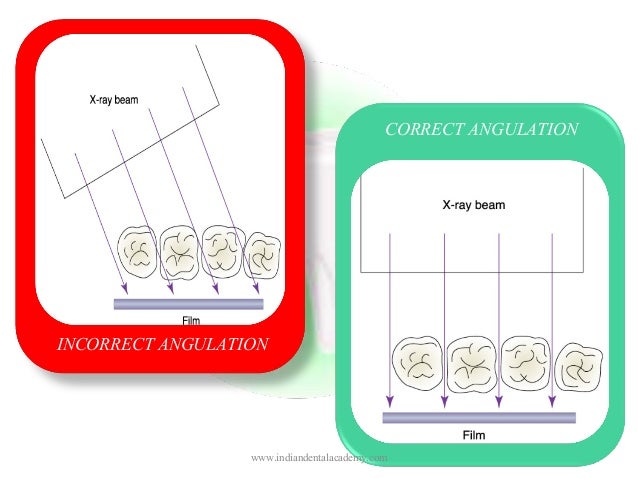 Intraoral radiographic techniques/prosthodontic courses