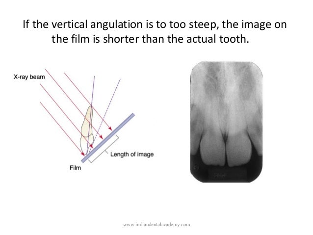 Intraoral radiographic techniques/prosthodontic courses