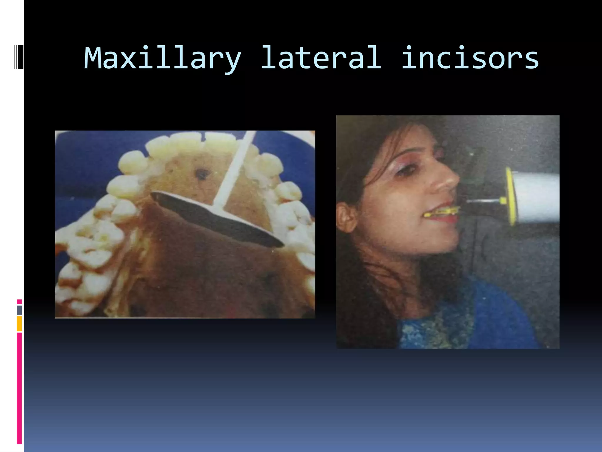 Intra oral radiographs | PPTX