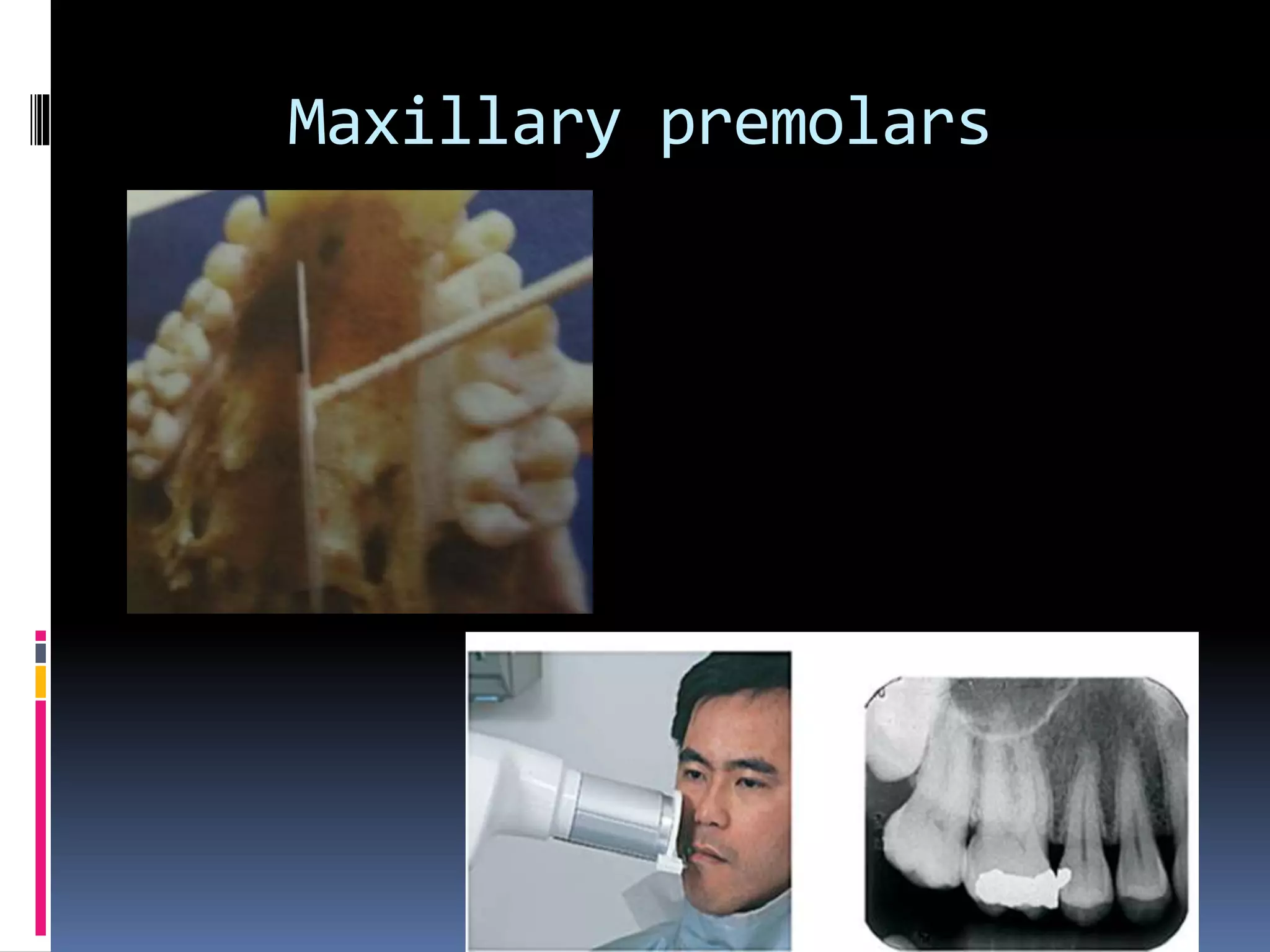 Intra oral radiographs | PPTX