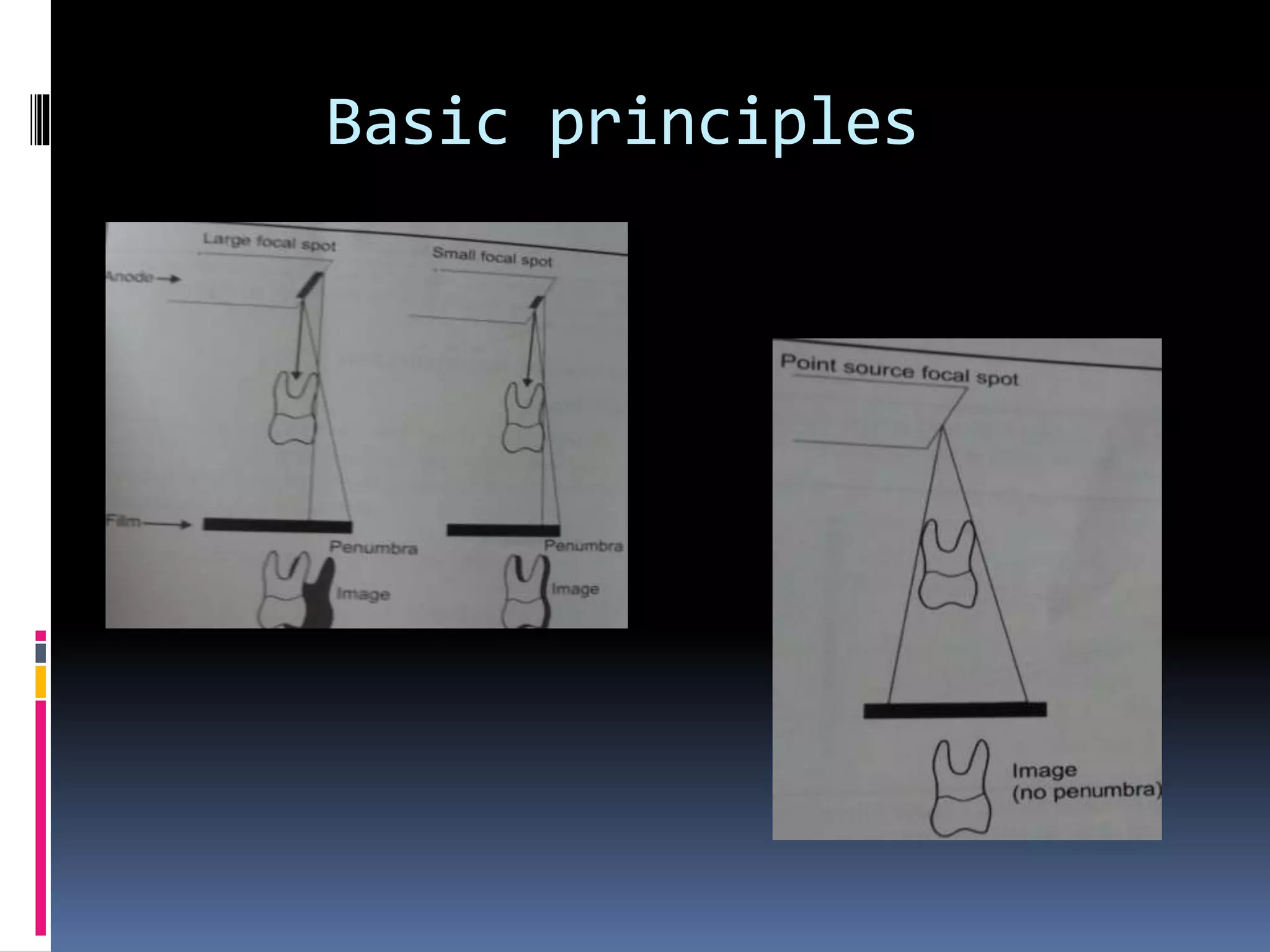 Intra oral radiographs | PPTX