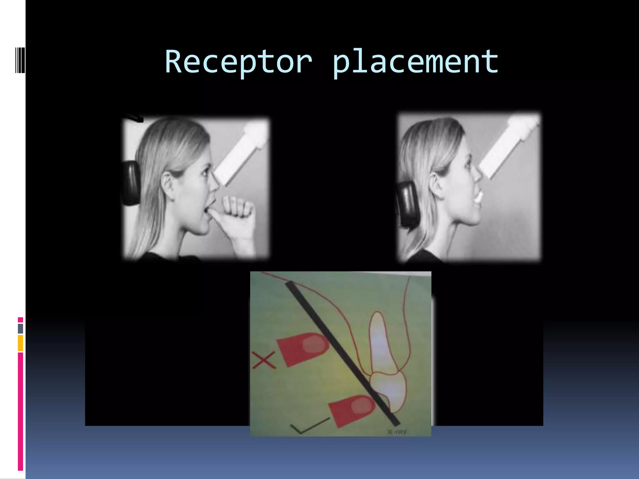 Intra oral radiographs | PPTX