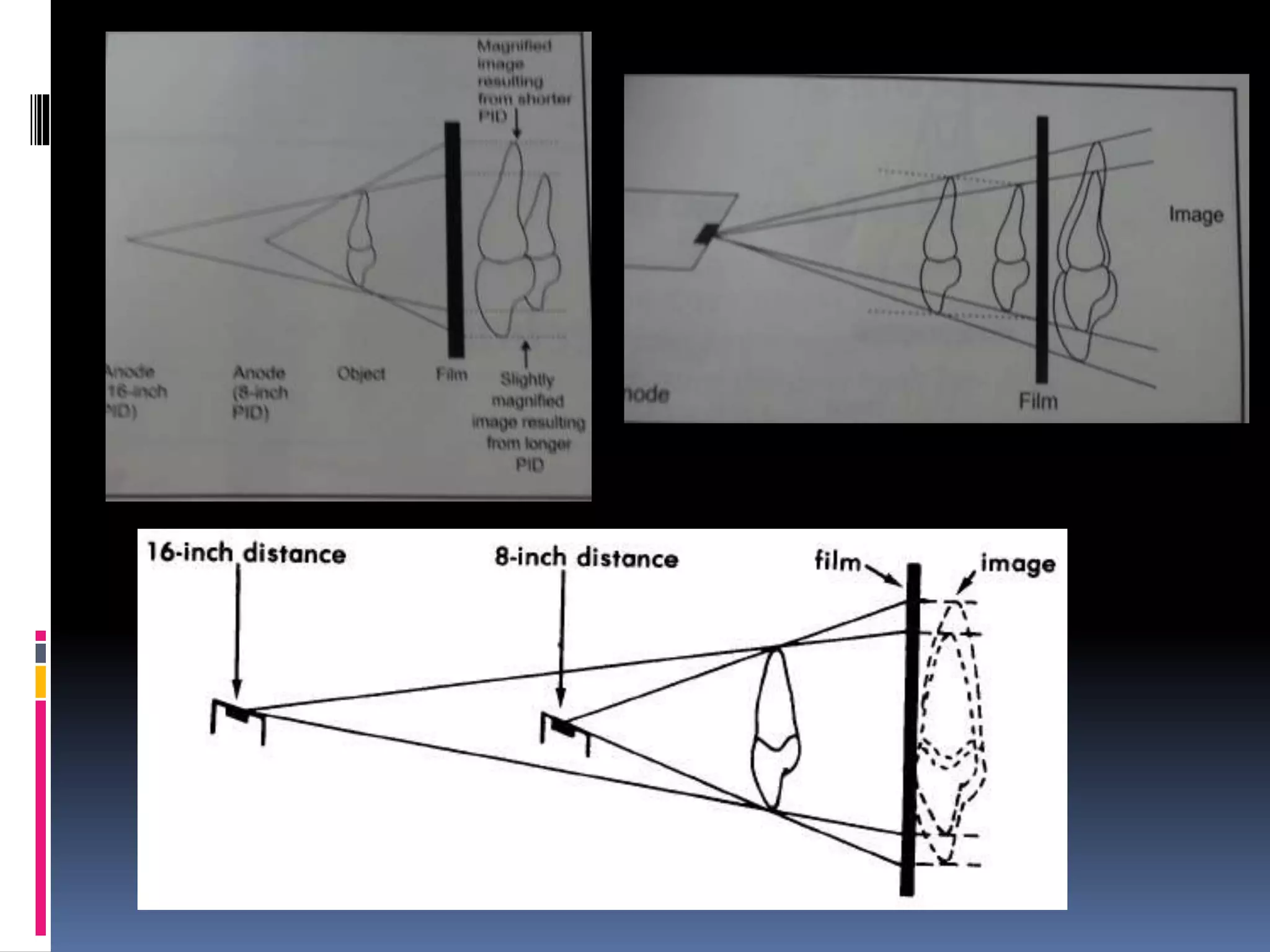 Intra oral radiographs | PPTX