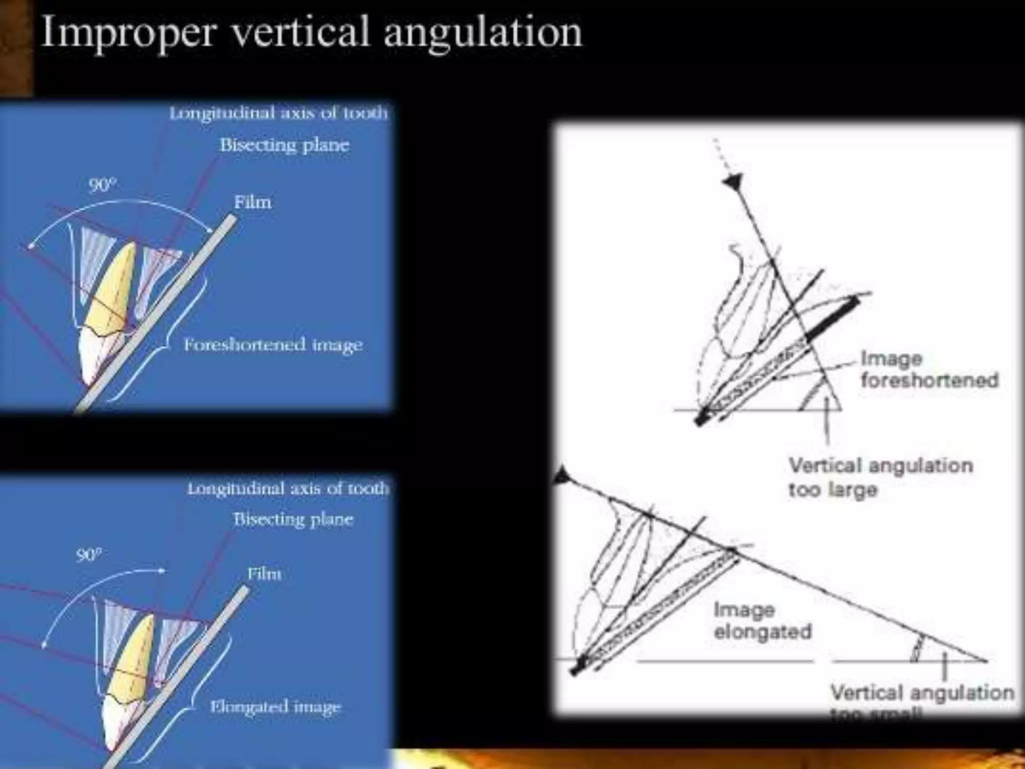 Intra oral radiographs | PPTX