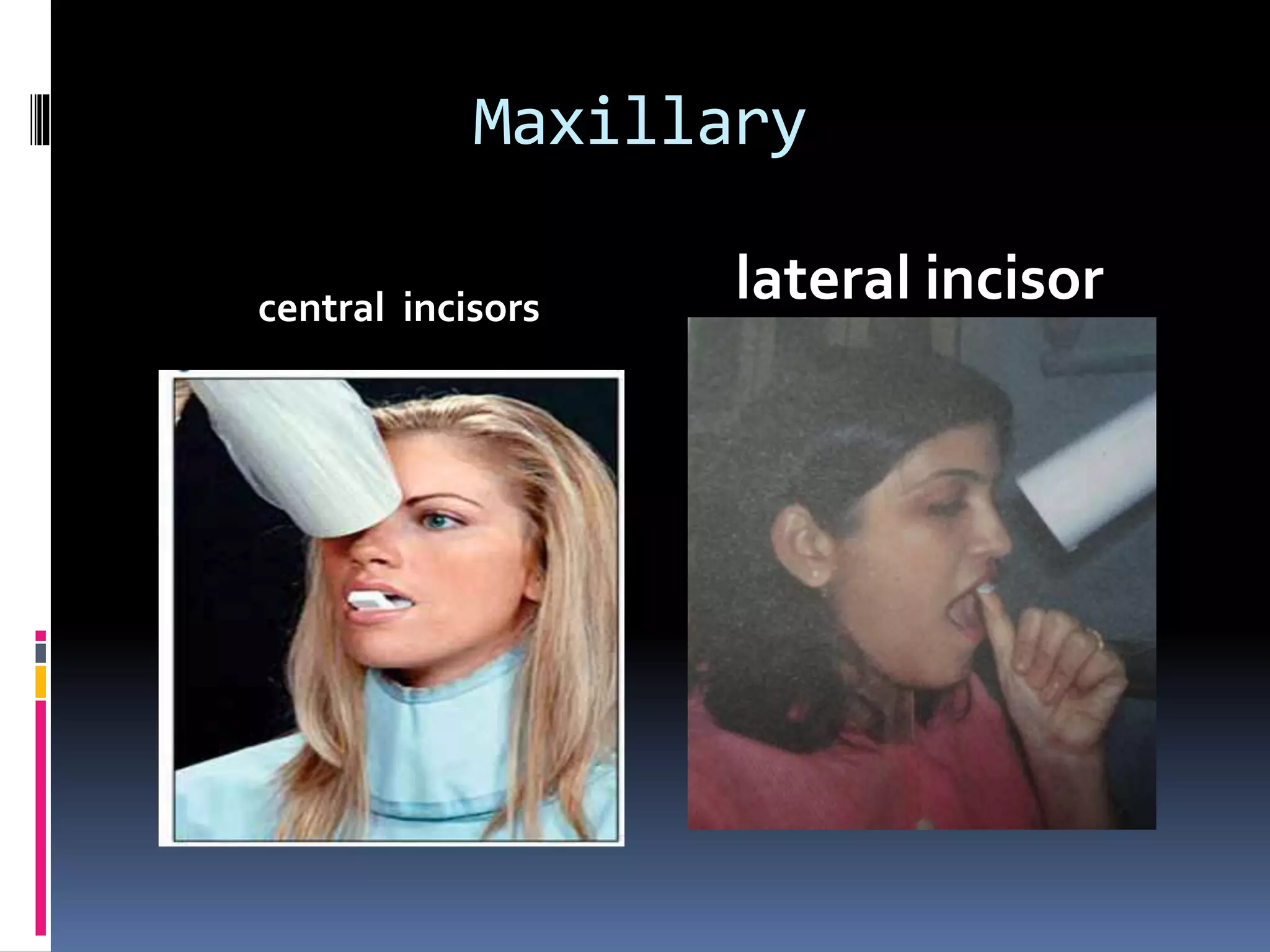 Intra oral radiographs | PPTX