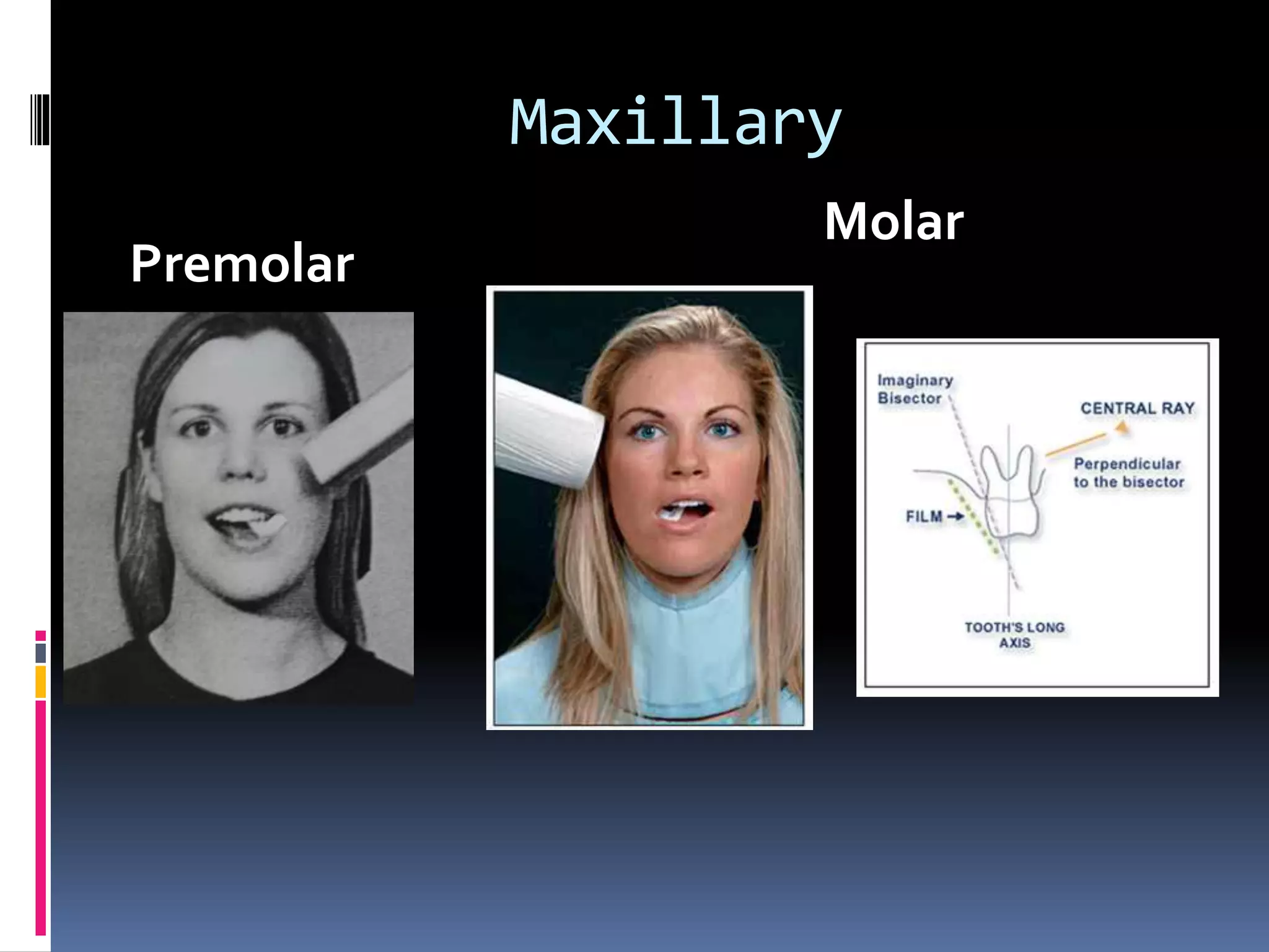 Intra oral radiographs | PPTX
