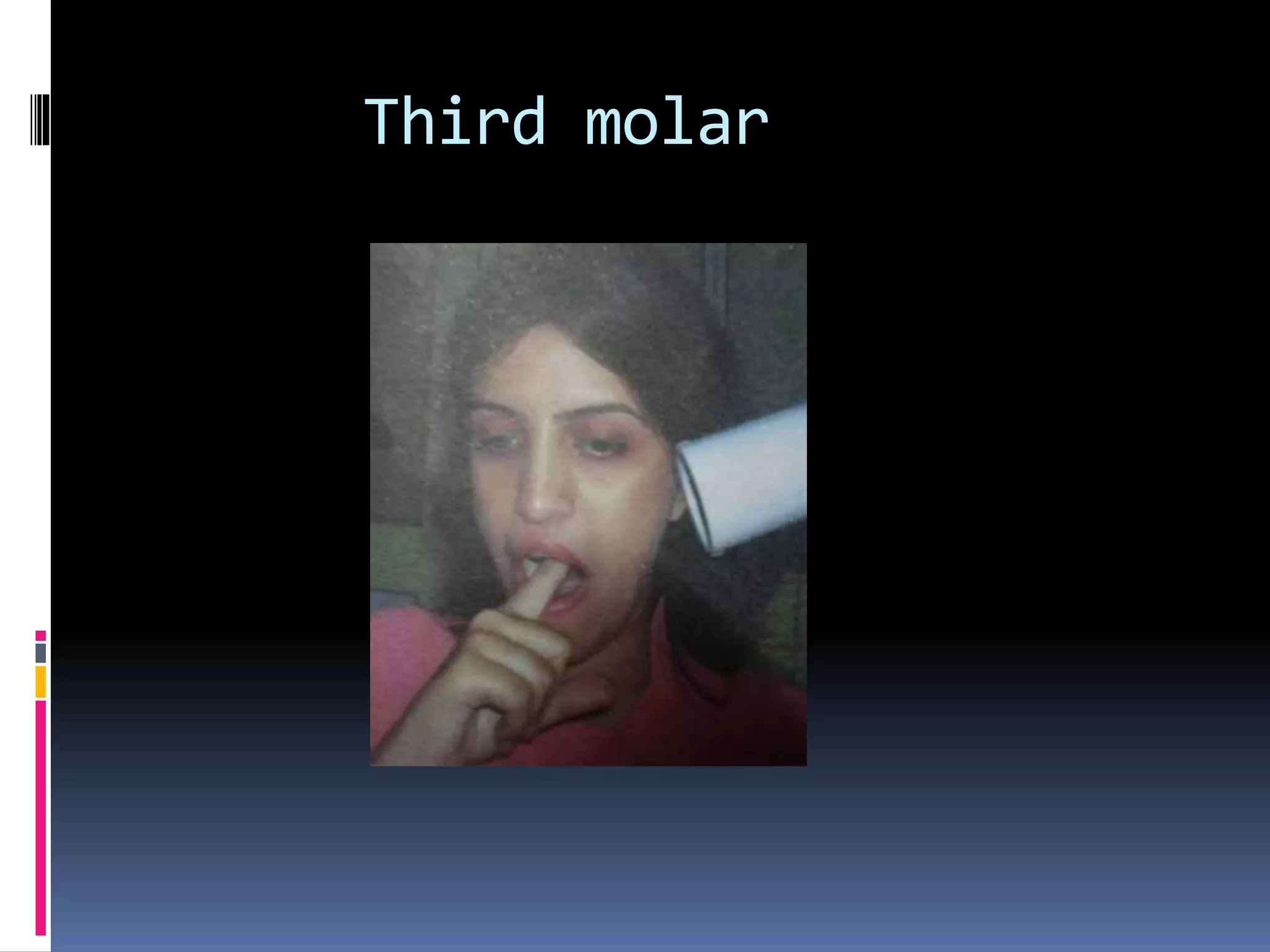 Intra oral radiographs | PPTX