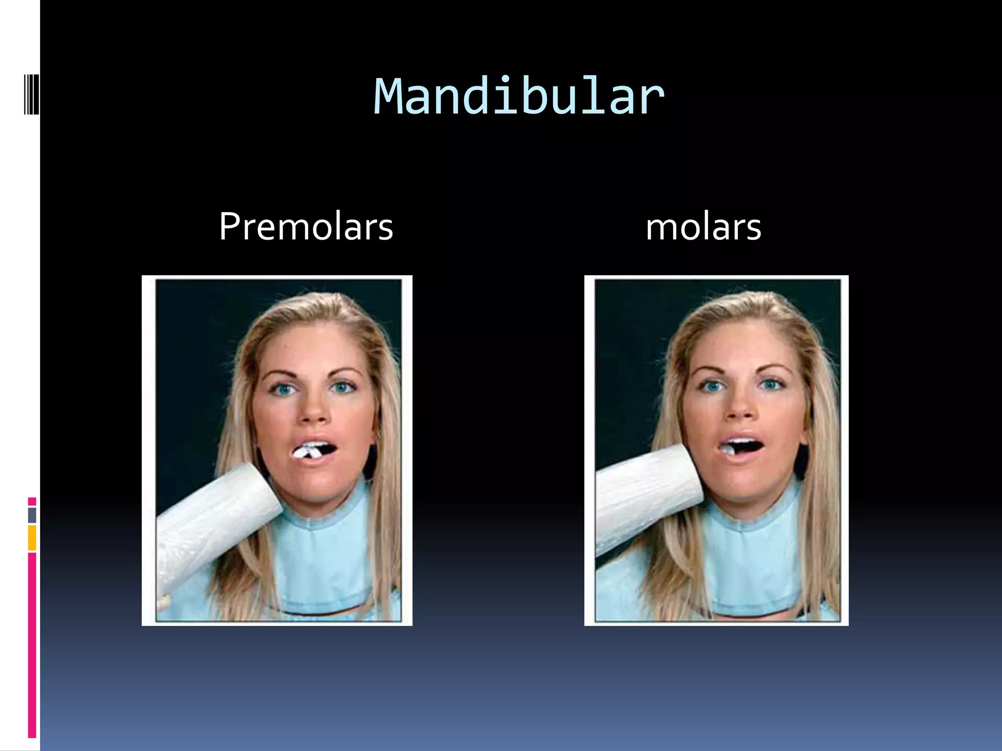 Intra oral radiographs | PPTX