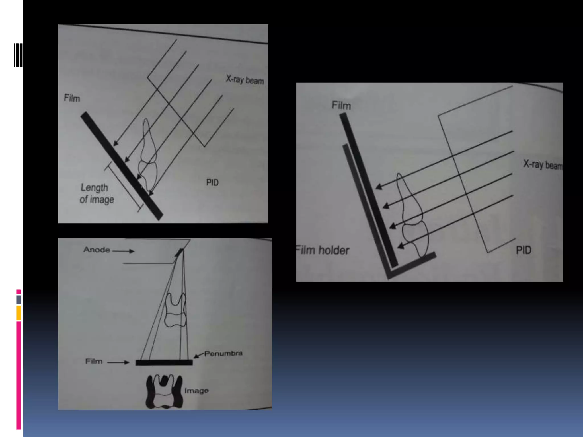 Intra oral radiographs | PPTX