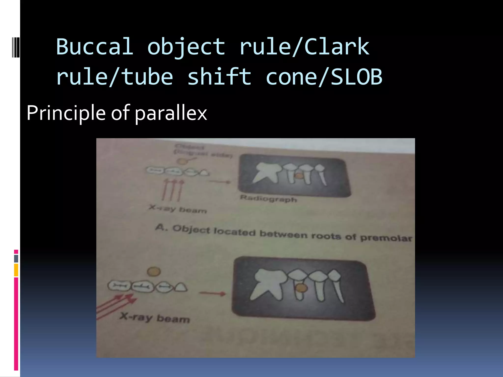 Intra oral radiographs | PPTX