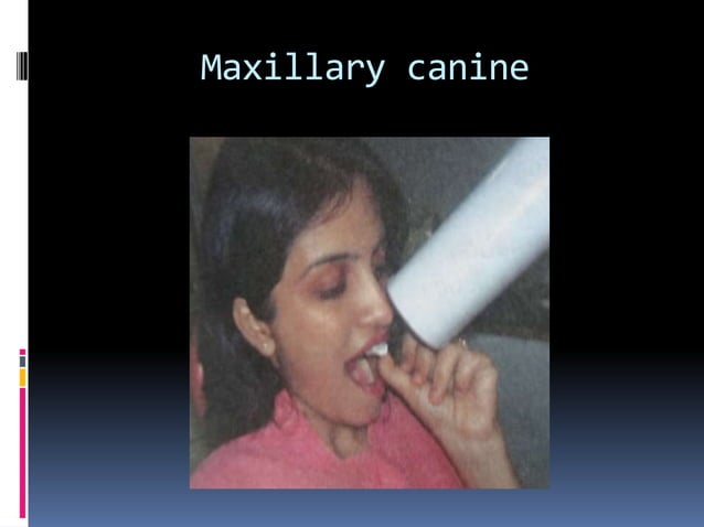 Intra oral radiographs | PPTX