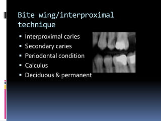 Intra oral radiographs | PPTX