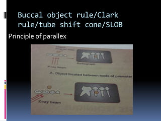Intra oral radiographs | PPTX