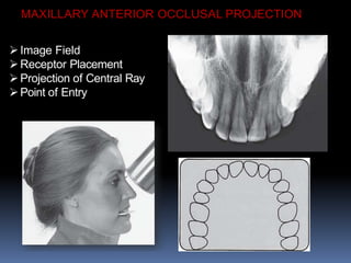 Intraoral_Radiography_Part_1.pptx for bds | PPT