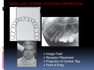 Intraoral_Radiography_Part_1.pptx for bds | PPT