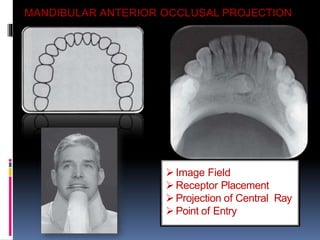 Intraoral_Radiography_Part_1.pptx for bds | PPT