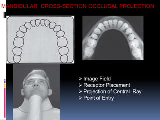 Intraoral_Radiography_Part_1.pptx for bds | PPT