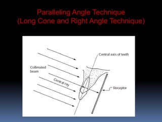 Intraoral_Radiography_Part_1.pptx for bds | PPT
