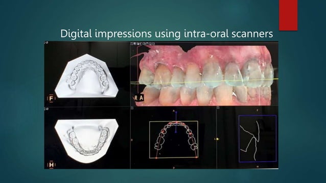 INTRA ORAL SCANNER FOR DENTISTRY DAILY USE | PPTX