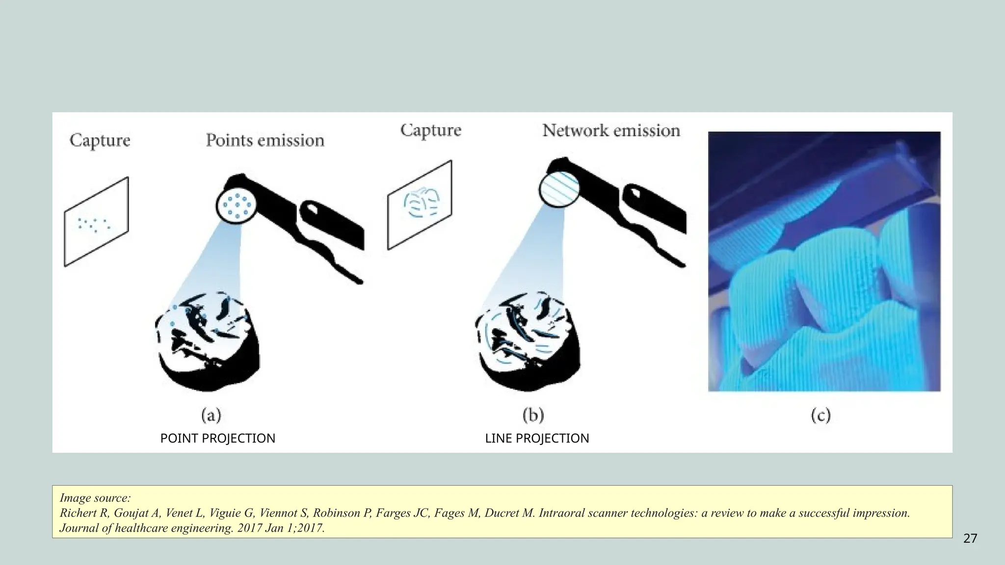 applications of INTRAORAL SCANNERS in dentistry | PPTX