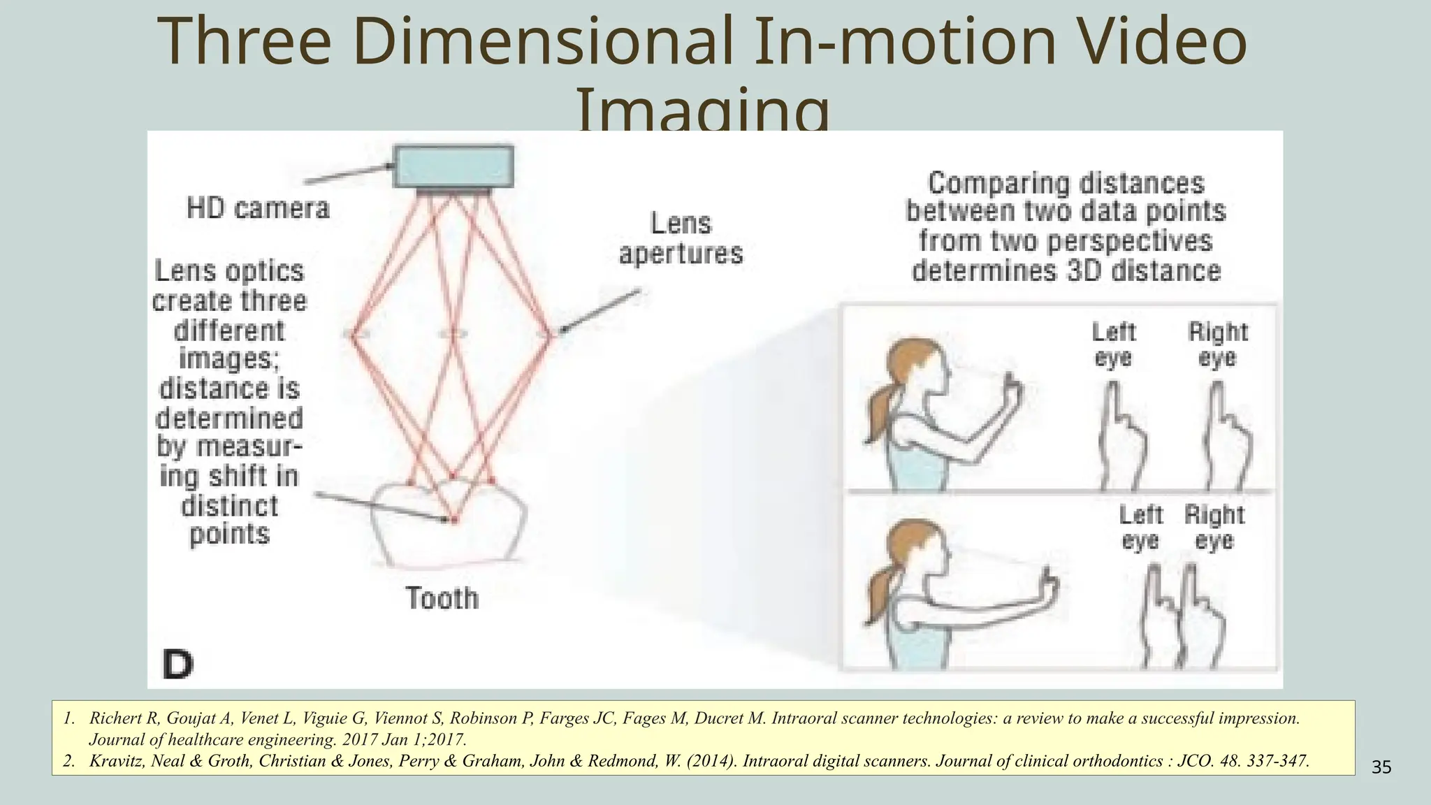applications of INTRAORAL SCANNERS in dentistry | PPTX