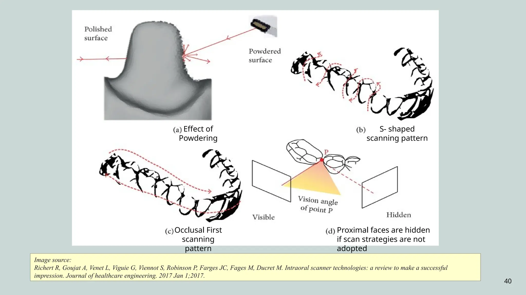 applications of INTRAORAL SCANNERS in dentistry | PPTX