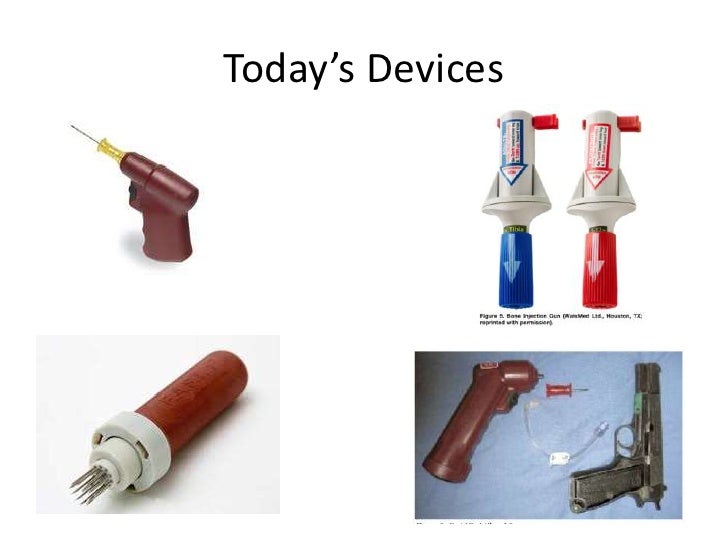 Intraosseous Access and the Emergency Nurse