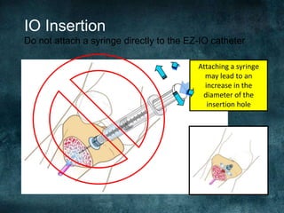 Intraosseous infusion mhs 536 | PPTX