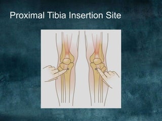Intraosseous infusion mhs 536 | PPTX