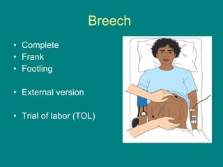 INTRAPARTUM | PPT